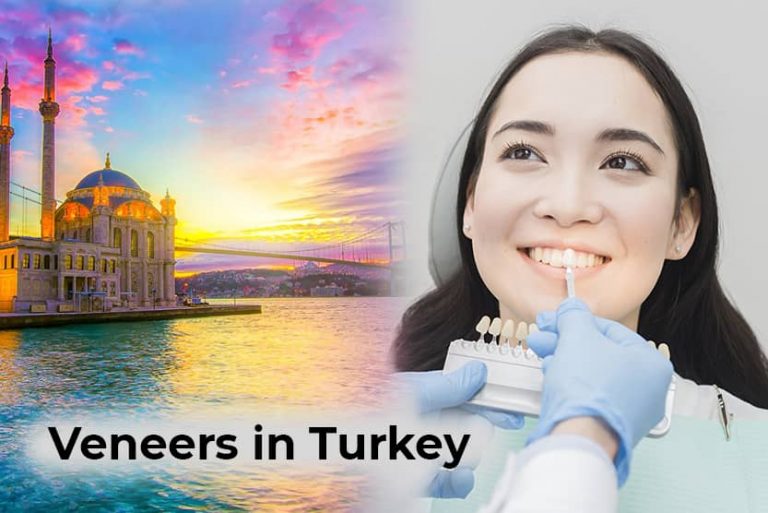 Teeth Implants in Turkey: Fill In The Blanks With The Best Teeth Implants in Turkey: Fill In The Blanks With The Best