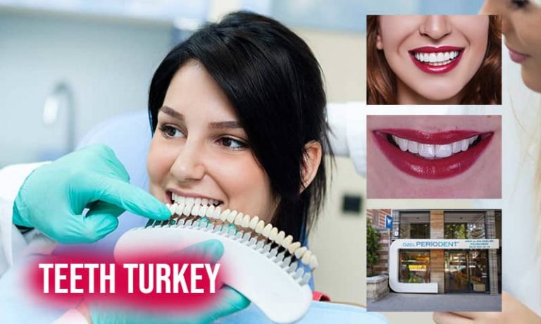 Get Your New Teeth In Turkey The Best Smile Makeover